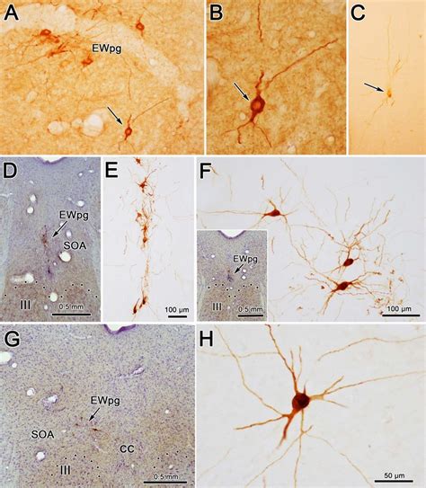 Morphology Of Labeled Neurons In The Ipsilateral Preganglionic Download Scientific Diagram
