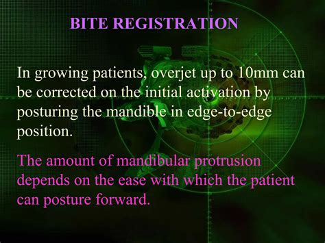 Twin Block Effects Ppt