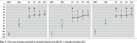 Figure 1 From Cochlear Implantation In Post Lingually Deafened Adults And Elderly Patients