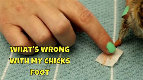 How To Fix Curl Toes On A Chick Youtube