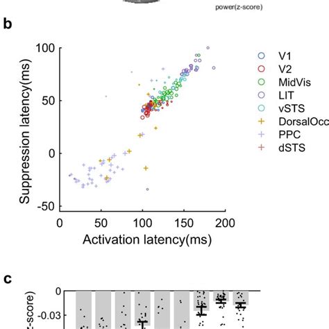 a 3d view depicting the ras coordinate system and the orientation of