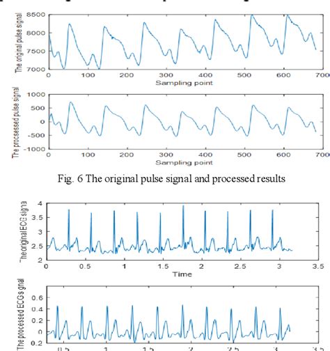Figure 6 From Health Monitoring System Design Of Iot Based Multi