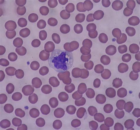 Définition Monocytes Structure Fonction Et Rôle Dans Limmunité