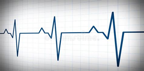 Audio Or Pulse Beat Wave Simple Graph Stock Illustration Illustration Of Diagnosis Curves