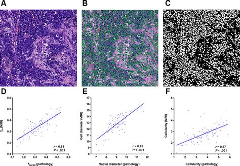 Time Dependent Diffusion Mri Helps Predict Molecular Subtypes And