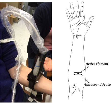 Figure 1 From Low Latency Gesture Recognition From Spatial Filtering Of Single Element