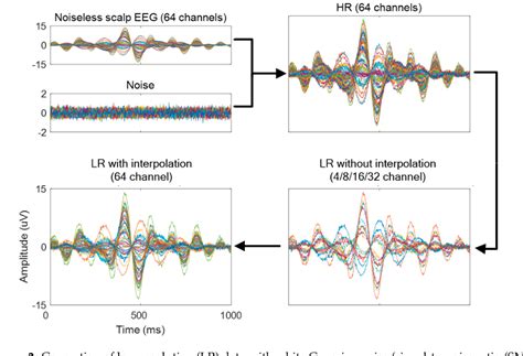 Figure 3 From Super Resolution For Improving EEG Spatial Resolution Using Deep Convolutional