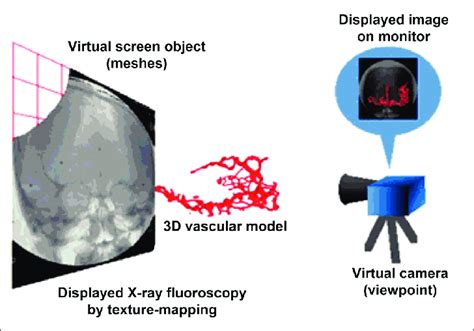 Augmented Reality Visualization Of A 3d Vascular Model With X Ray Download Scientific Diagram