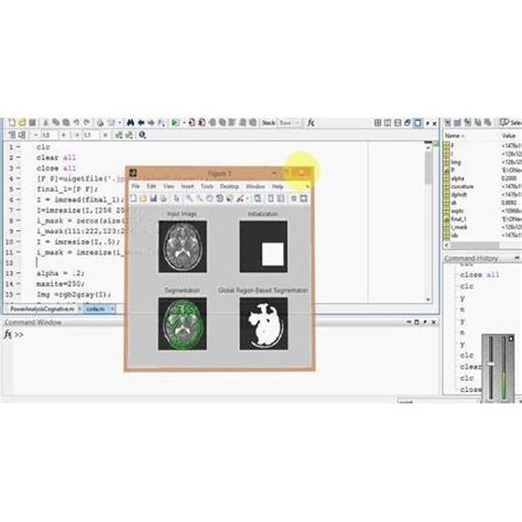 Improved Image Segmentation Using Contour Model Classification Techpacs Canada Limited
