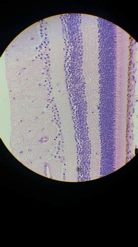 Final Lab Exam Flashcards Quizlet
