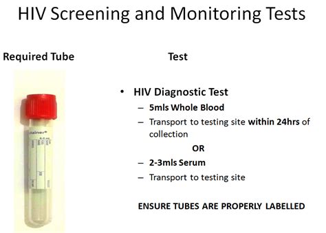 Hiv Testing In Jamaica Page 2 Ministry Of Health And Wellness