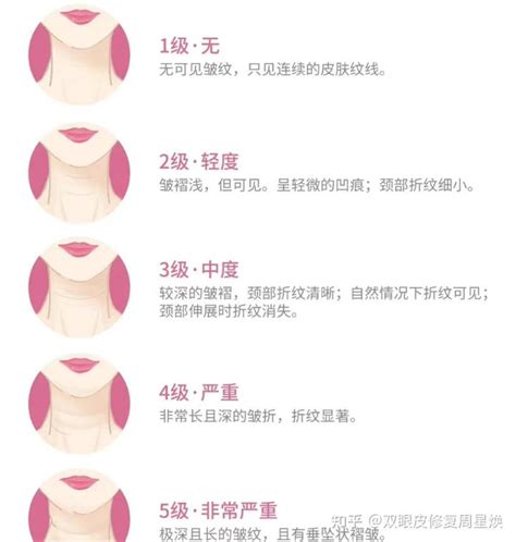 周星焕双眼皮修复 知乎