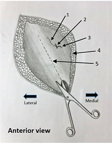 Illustration Image Of Right Inguinal Area Part Of The Proximal Download Scientific Diagram