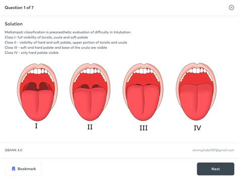 Mallampatti Classification Soft Palate Classification Anesthesia