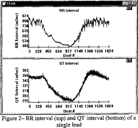 Figure 2 From Dynamic Qt Rr Relationships In 12 Lead Ecg In Patients