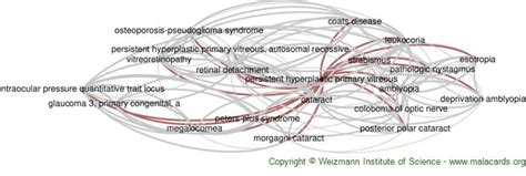 Persistent Hyperplastic Primary Vitreous Disease Malacards Research