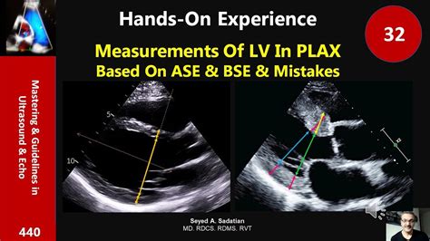 Measurements Of Lv In Plax Based On Ase And Bse And Mistakes Hands On 32 Youtube