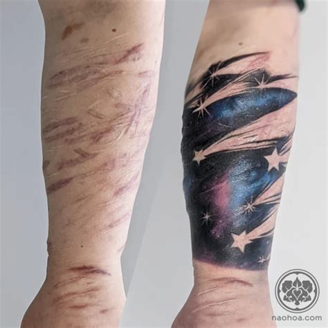 See What A Tattoo Can Look Like When Keloid Learn The Risks And How To Prevent It