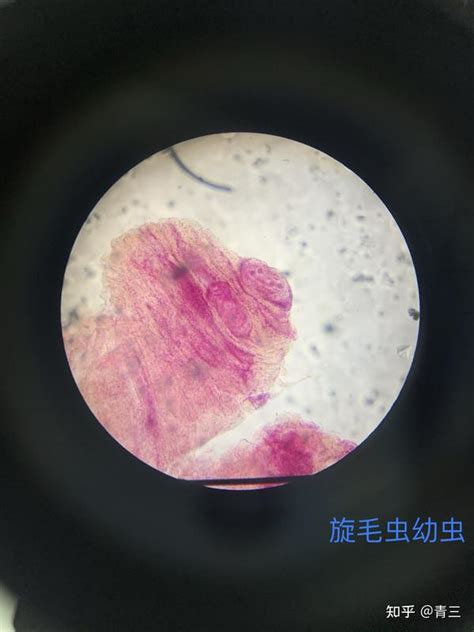 医学寄生虫学 知乎