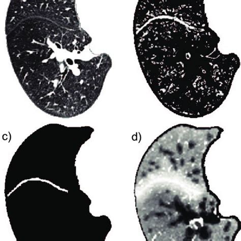 Pdf Automatic Segmentation Of Lung Lobes In Ct Images Based On Fissures Vessels And Bronchi