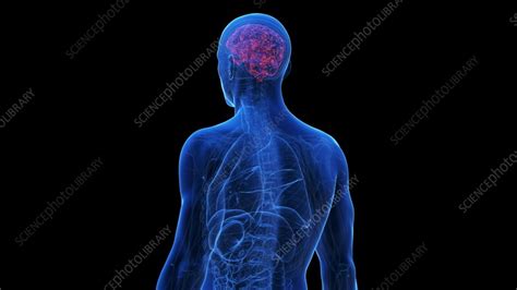 Animation Of An Infected Brain Stock Video Clip K0120099 Science Photo Library