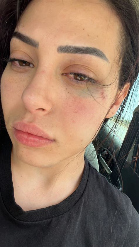 Ανεγκέφαλοι