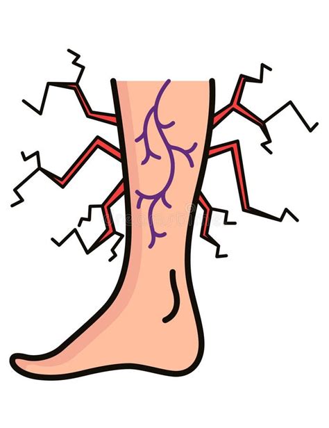 Varicose Treatment Icon Violation Of Circulatory System Vascular