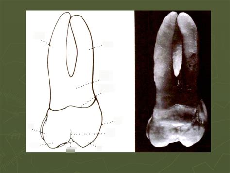 Maxillary 1st Molar Buccal View Diagram Quizlet