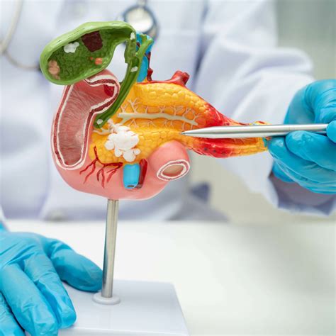 New Screening Offers Hope In Early Detection Of Pancreatic Cancer Brown Surgical Associates