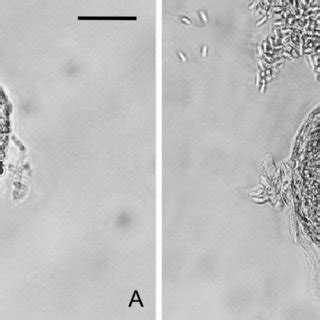 Pycnidial Fungicolous Fungi A Ampelomyces Quisqualis Pycnidium In