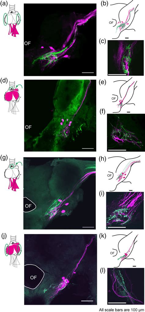 Axonal Projections Of Böhms Bristles Fields Extensively Overlap With