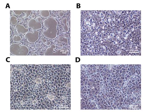 The Sequential Morphological Changes During Hepatic Differentiation Download Scientific