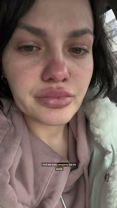 Сонный паралич у клиентки Youtube