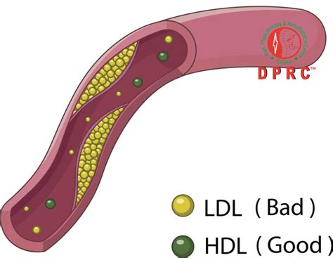 দরঘ জবনর জনয HDL কলসটরল পরযজন