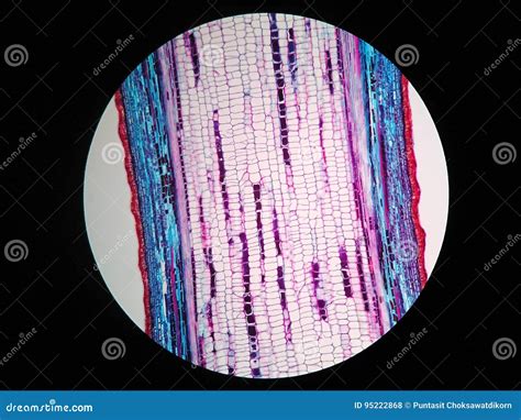 Longitudinal Xylem And Phloem Microscope Micropedia