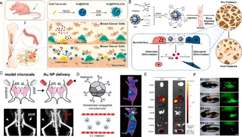 Bone Targeted Inorganic Nanoparticles A Au MSNs Combine ZOL And PTT Download Scientific