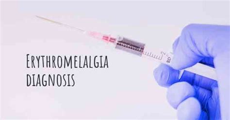 How Is Erythromelalgia Diagnosed