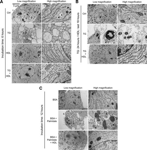 Hdls Prevent Tg And Palmitate Induced Er Morphology Alterations Min6