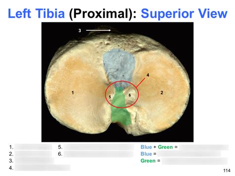 Left Tibia Superior Diagram Quizlet