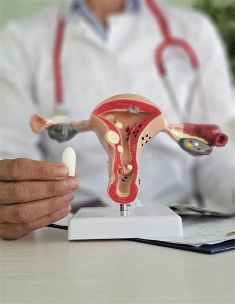 Model Of Female Reproductive System And Suppository Medical Tablet Stock Image Image Of