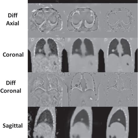 Comparison Of The Reconstructed Cbct Volumes Between Inrpoly Pcacv Download Scientific