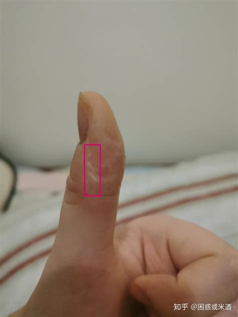 不啃手指甲的打卡日常 知乎