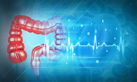 Intelligent Scopes Brings Ai To Colon Cancer Detection Prism Marketview