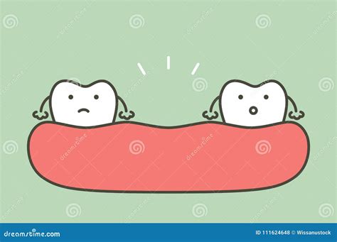 Missing Tooth Space Between Teeth In Mouth Stock Vector Illustration