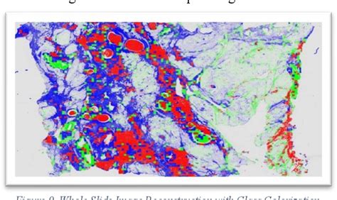 Figure 9 From Enhanced Deep Learning Based Cad System For Breast Cancer Diagnosis From