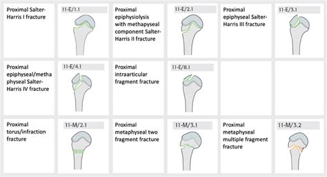 Fracture Classification According To The Aoota Classification System