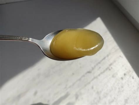 3 პროდუქტი რომლის გამოც სისხლძარღვები თრომბით იჭედება რჩევები ვივიენისგან