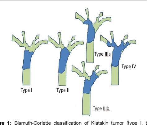 Figure 1 From Current Status Of Endoscopic Treatment Of Advanced Hilar