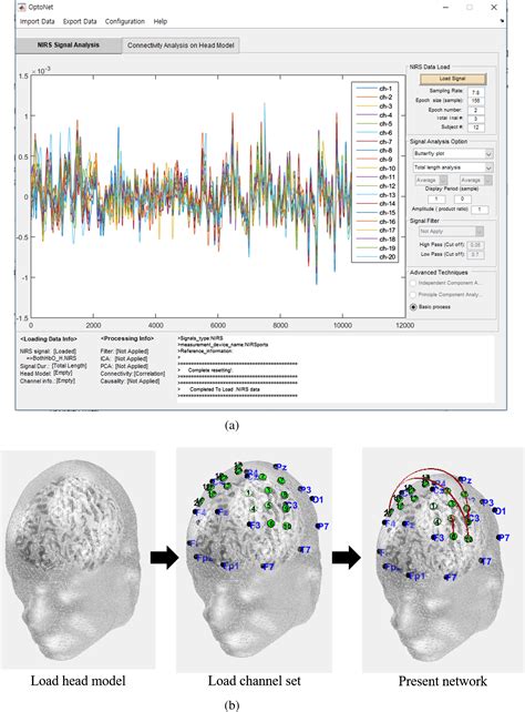 Optonet A Matlab Based Toolbox For Cortical Network Analyses Using Functional Near Infrared