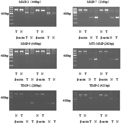 Reverse Transcriptase Polymerase Chain Reaction Analysis Of Mrna